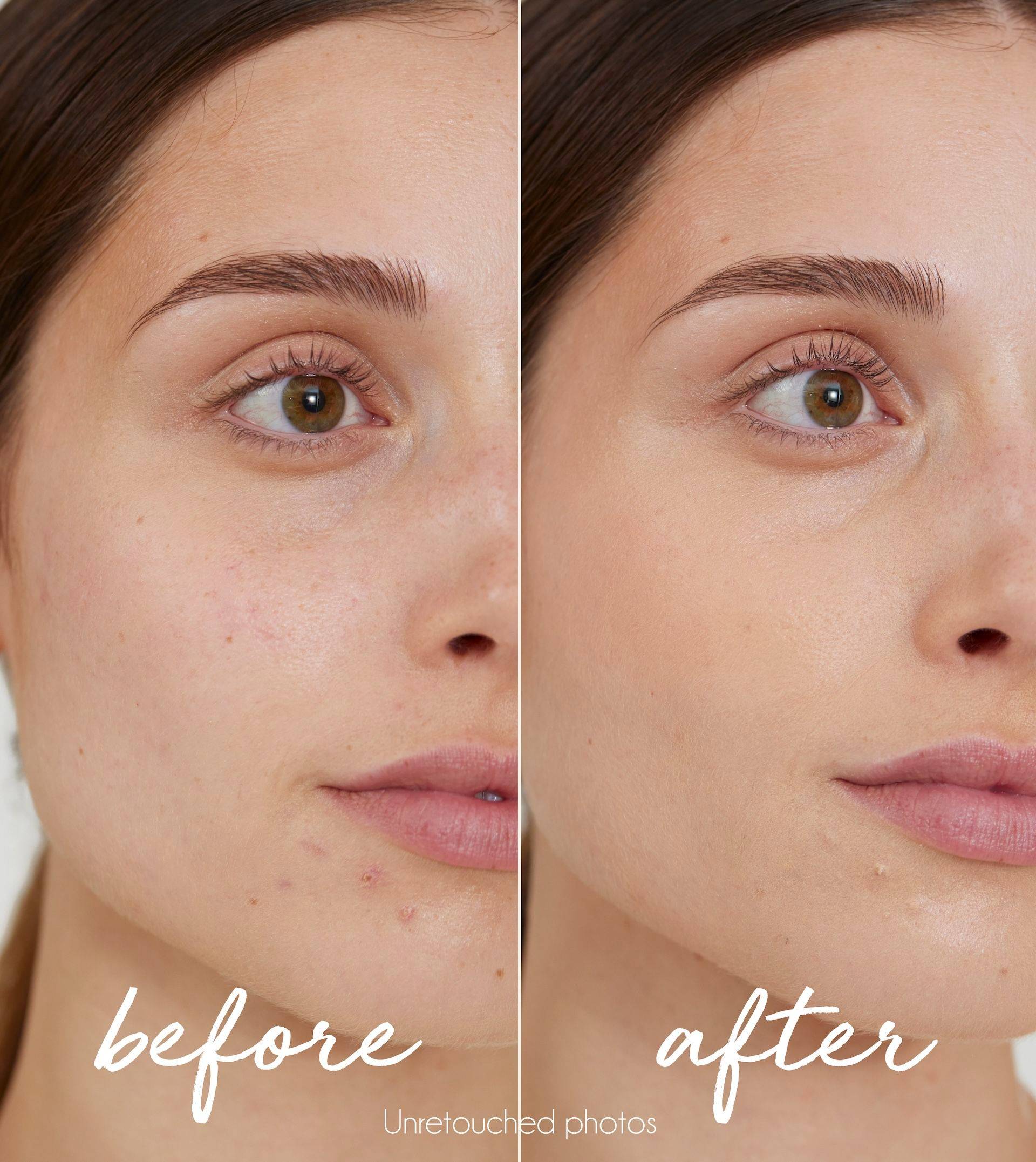 Anti-Blemish Tinted Concealer Stick Duo + Refill | La Rosée cosmétiques